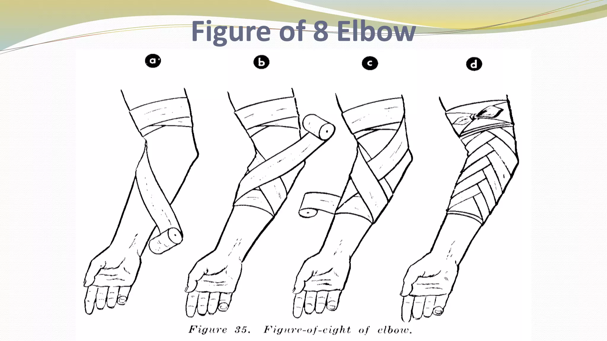 Bandaging.pptx | First Aid | Injuries