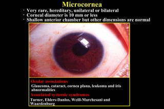 19 congen corneal anoms | PPT