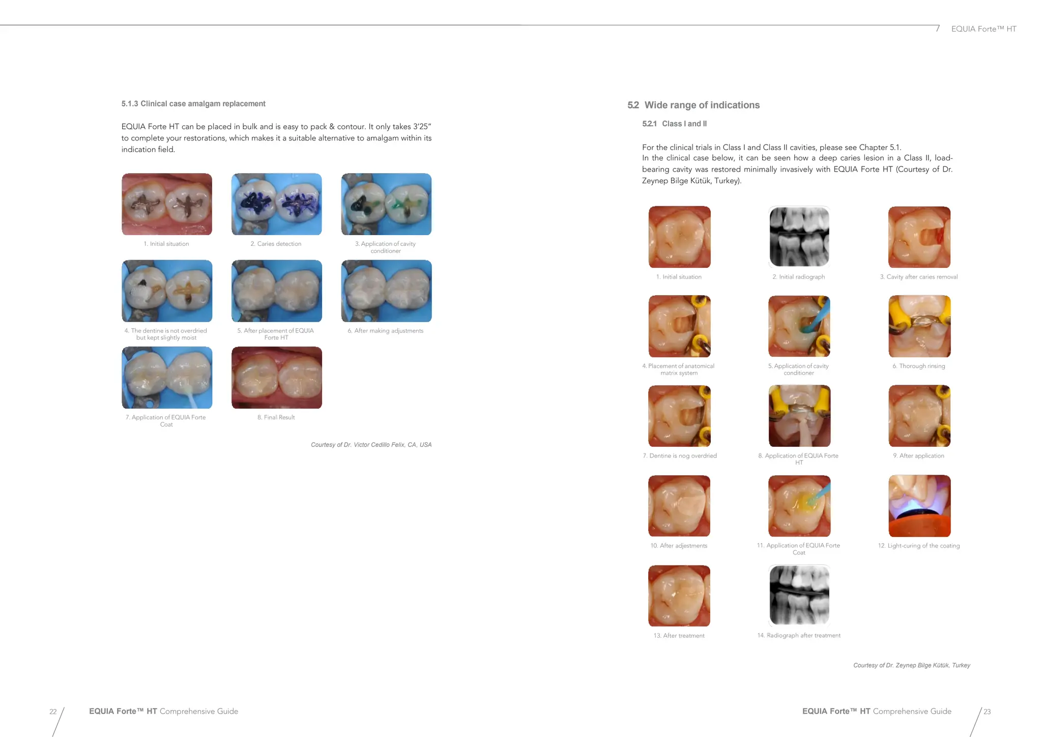 equia-forte-ht-comprehensive-guide.pdf
