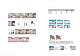 equia-forte-ht-comprehensive-guide.pdf