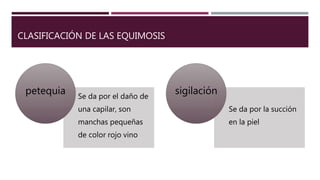 Equimosis, hematoma diferencia entre equimosis y hematoma | PPTX