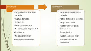 Equimosis y Hematomas | PPTX