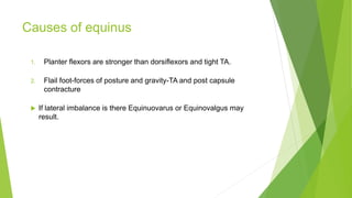 Equinus | PPTX