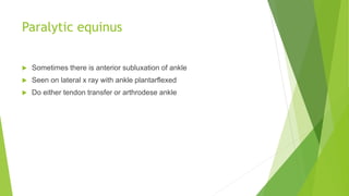 Equinus | PPTX