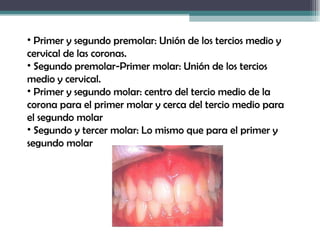 Planos y Curvas de la Oclusión Equipo 4 1012 | PPT