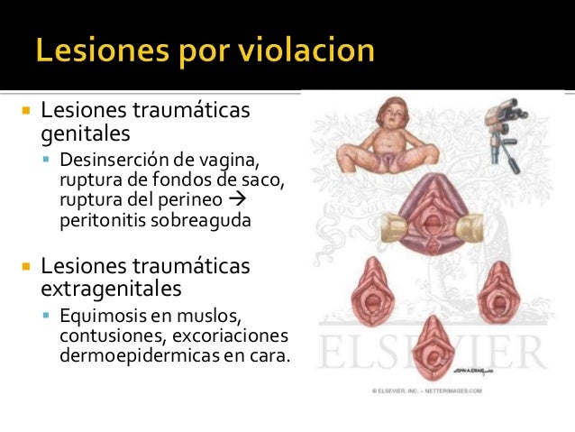 Delitos sexuales