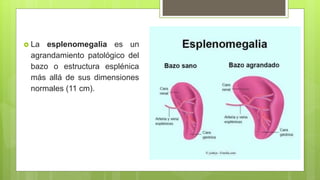 cirugia oncologica. esplenectomia tecnica quirurgica | PPTX