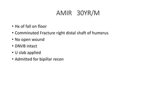 Emergency department bone fracture management | PPT