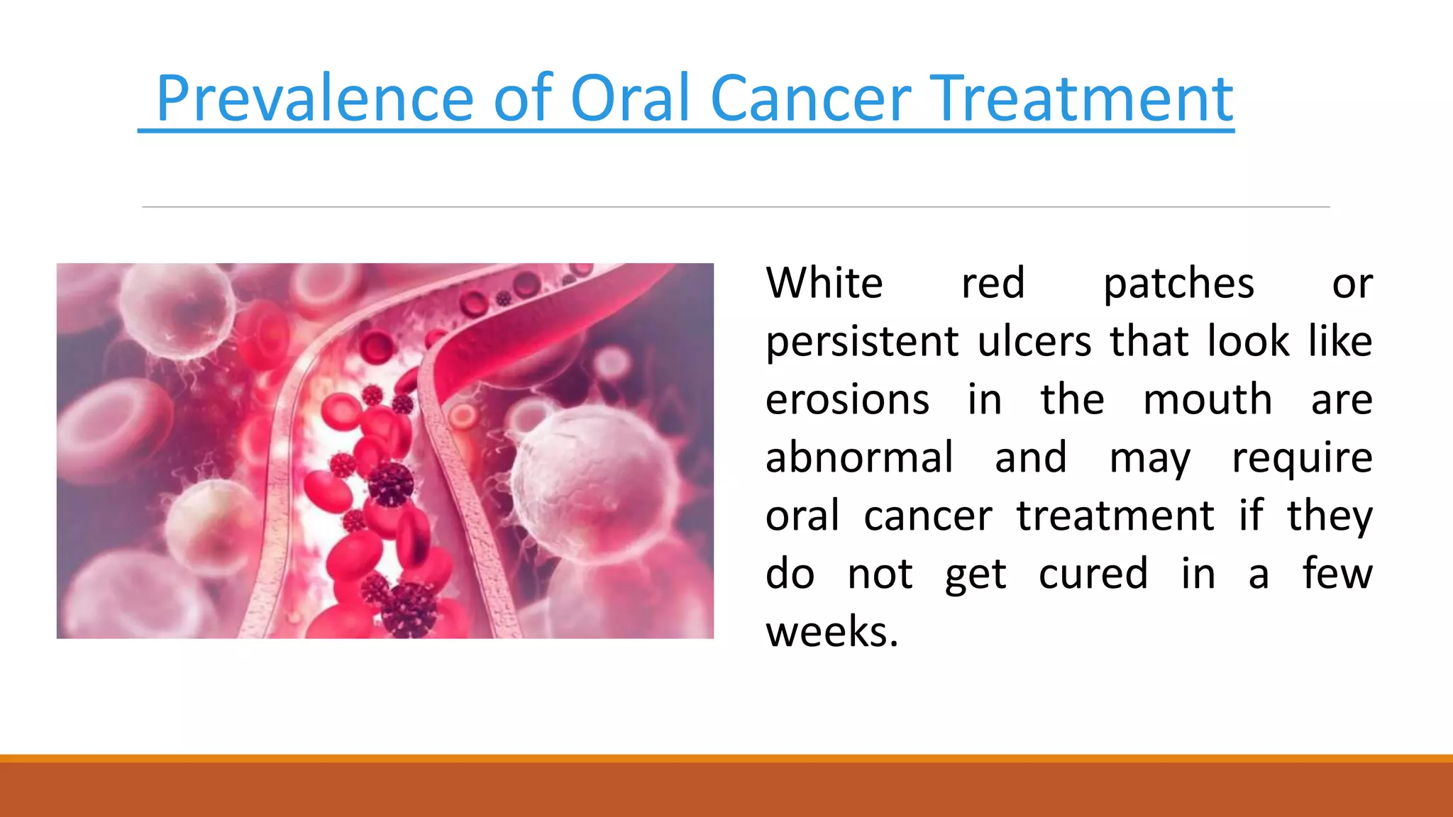 Eradicate Oral Cancer with Mouth Cancer Treatment | PPT