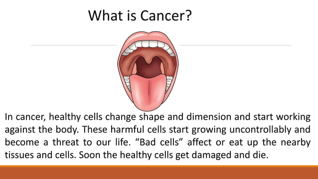 Eradicate Oral Cancer With Mouth Cancer Treatment Ppt