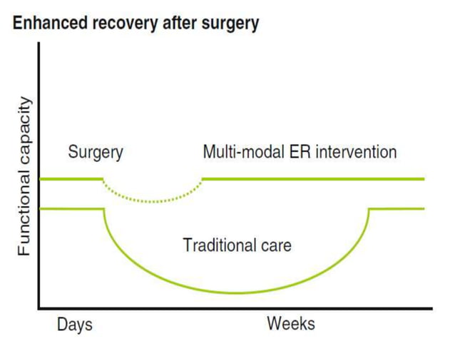 Enhanced Recovery After Surgery | PPTX | Digestive Disorders | Diseases ...
