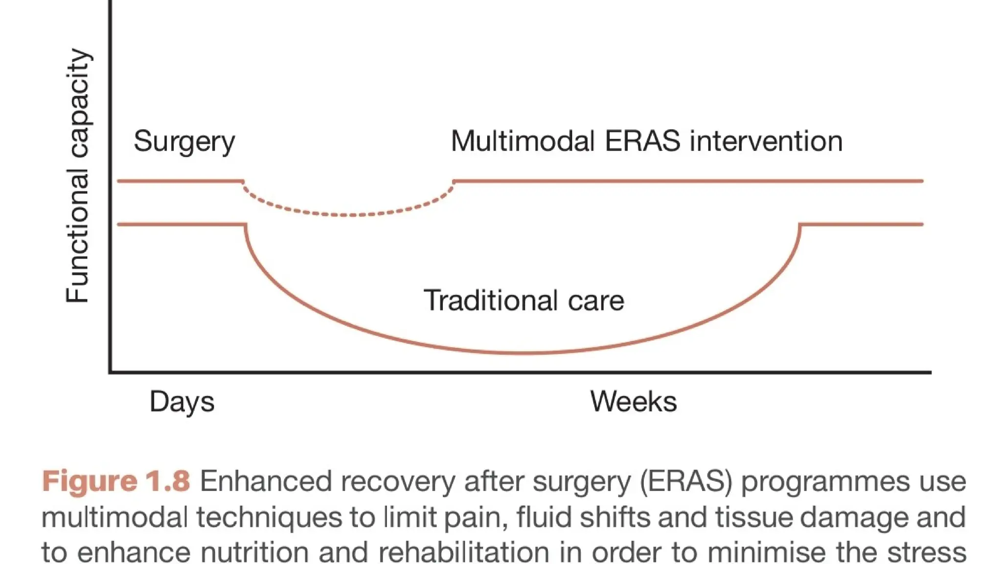 Enhanced recovery after surgery(2024).pptx