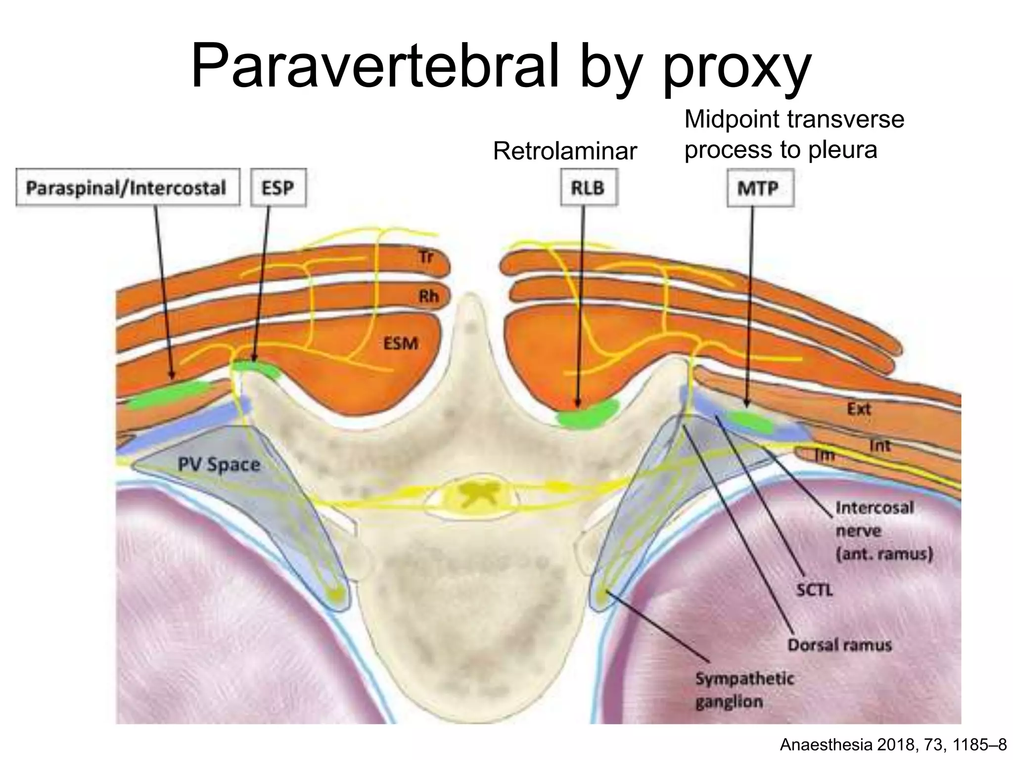 Eras 20210926 talk spine multimodal analgesia clean | PPTX