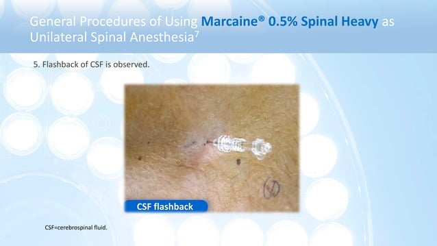 ERAS & Marcaine 0.5% Spinal Heavy_slide.pdf