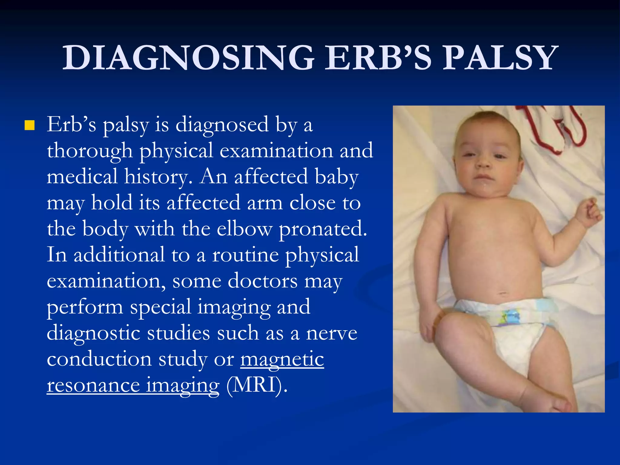 Erbs palsy | PPT