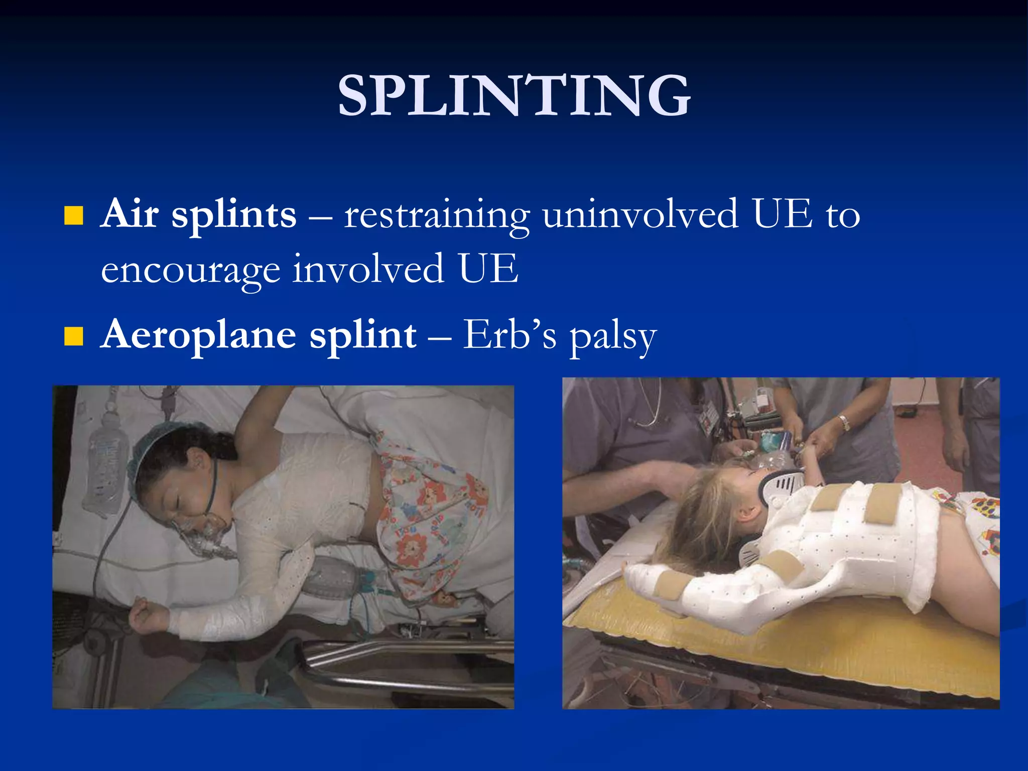 Erbs palsy | PPT