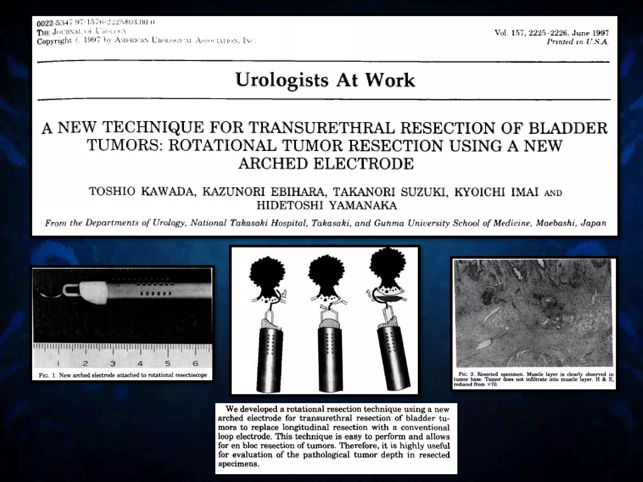 Erb tendourology section | PPTX