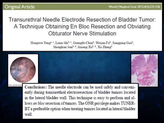 Erb tendourology section | PPT