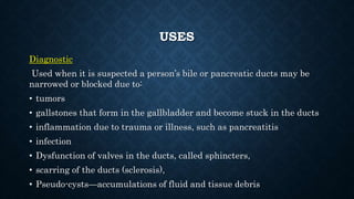 Ercp | PPTX