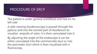 Ercp | PPTX