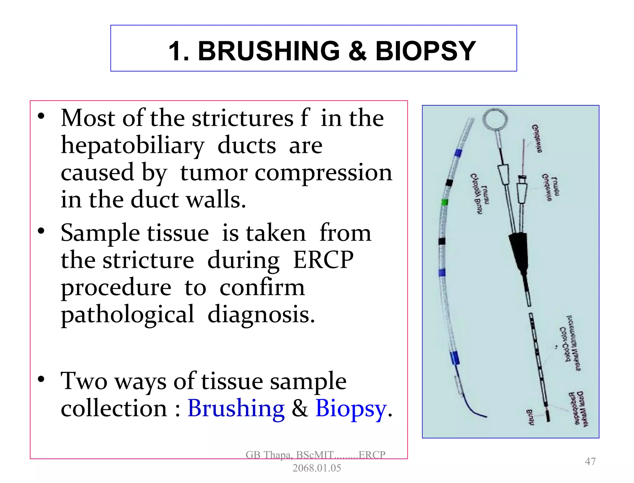 ERCP PROCEDURE | PPT