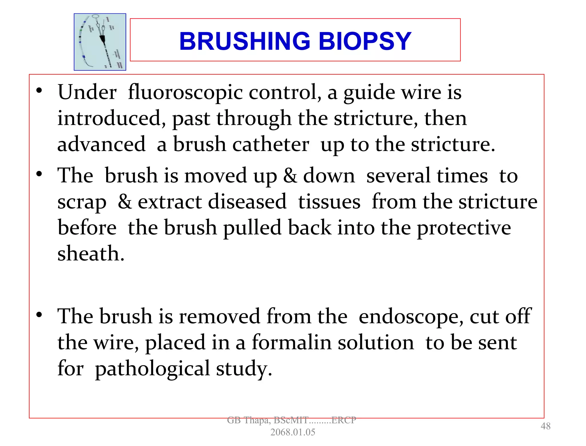 ERCP PROCEDURE | PPT