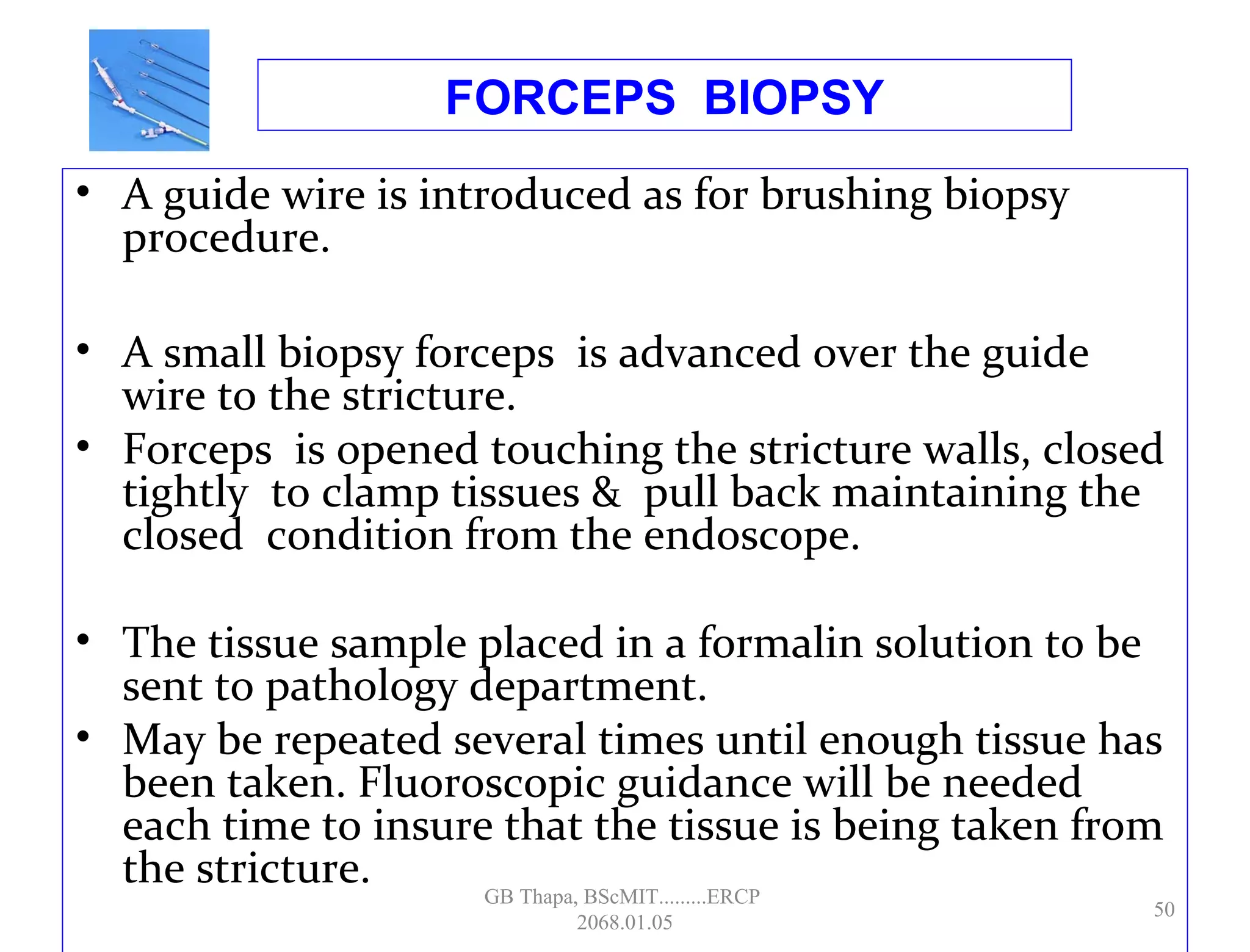 ERCP PROCEDURE | PPT