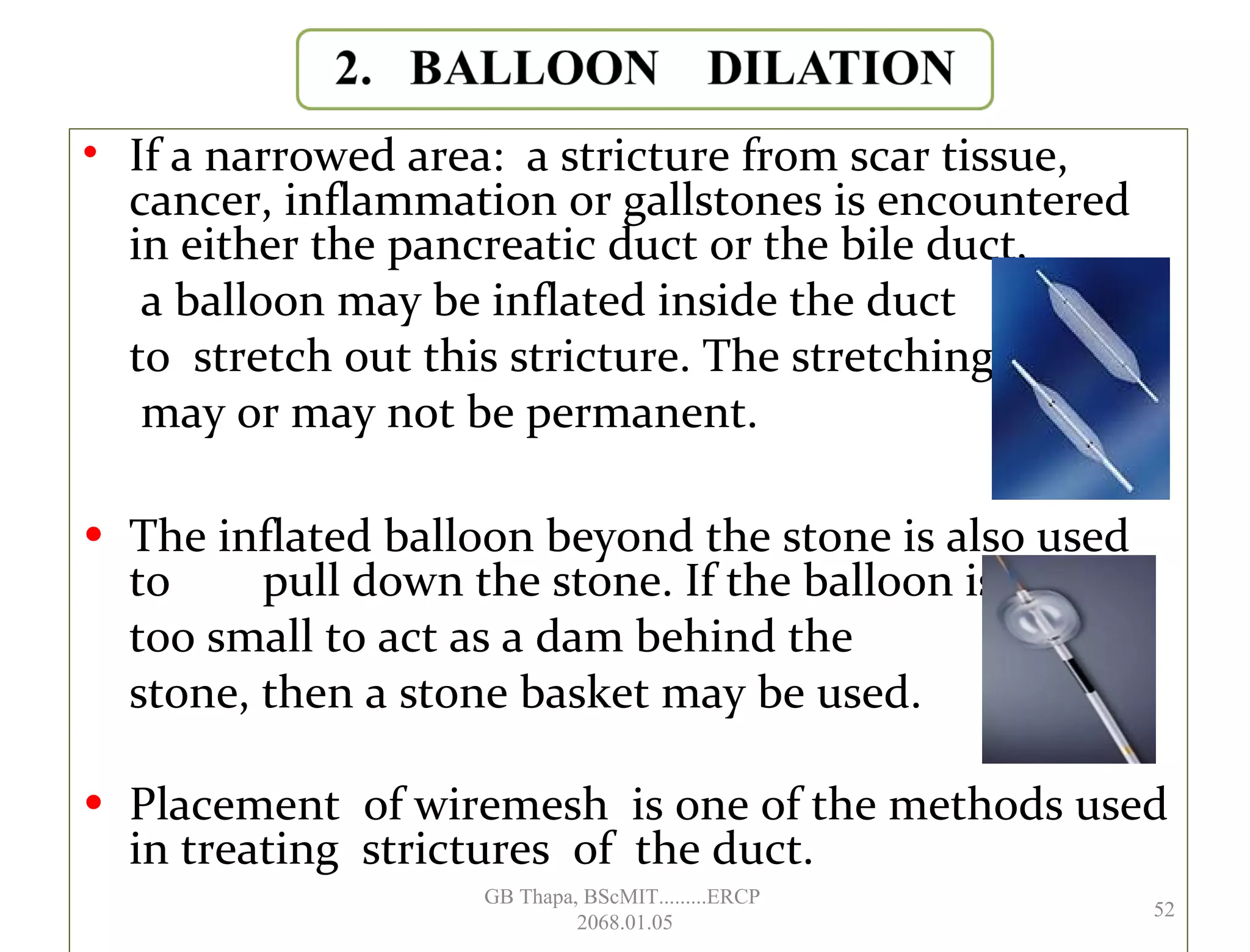 ERCP PROCEDURE | PPT