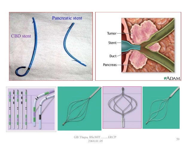 ERCP PROCEDURE