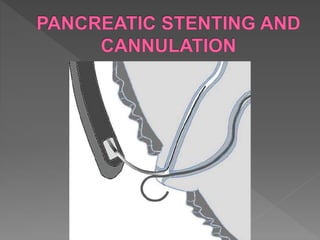 Ercp- for Beginners | PPTX
