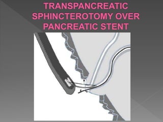 Ercp- for Beginners | PPTX