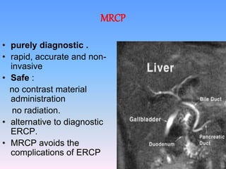 ERCP.ppt