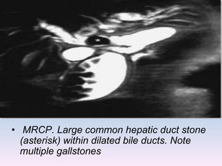 ERCP.ppt