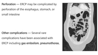ERCP.pptx