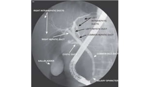 ERCP.pptx