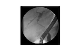 ERCP.pptx