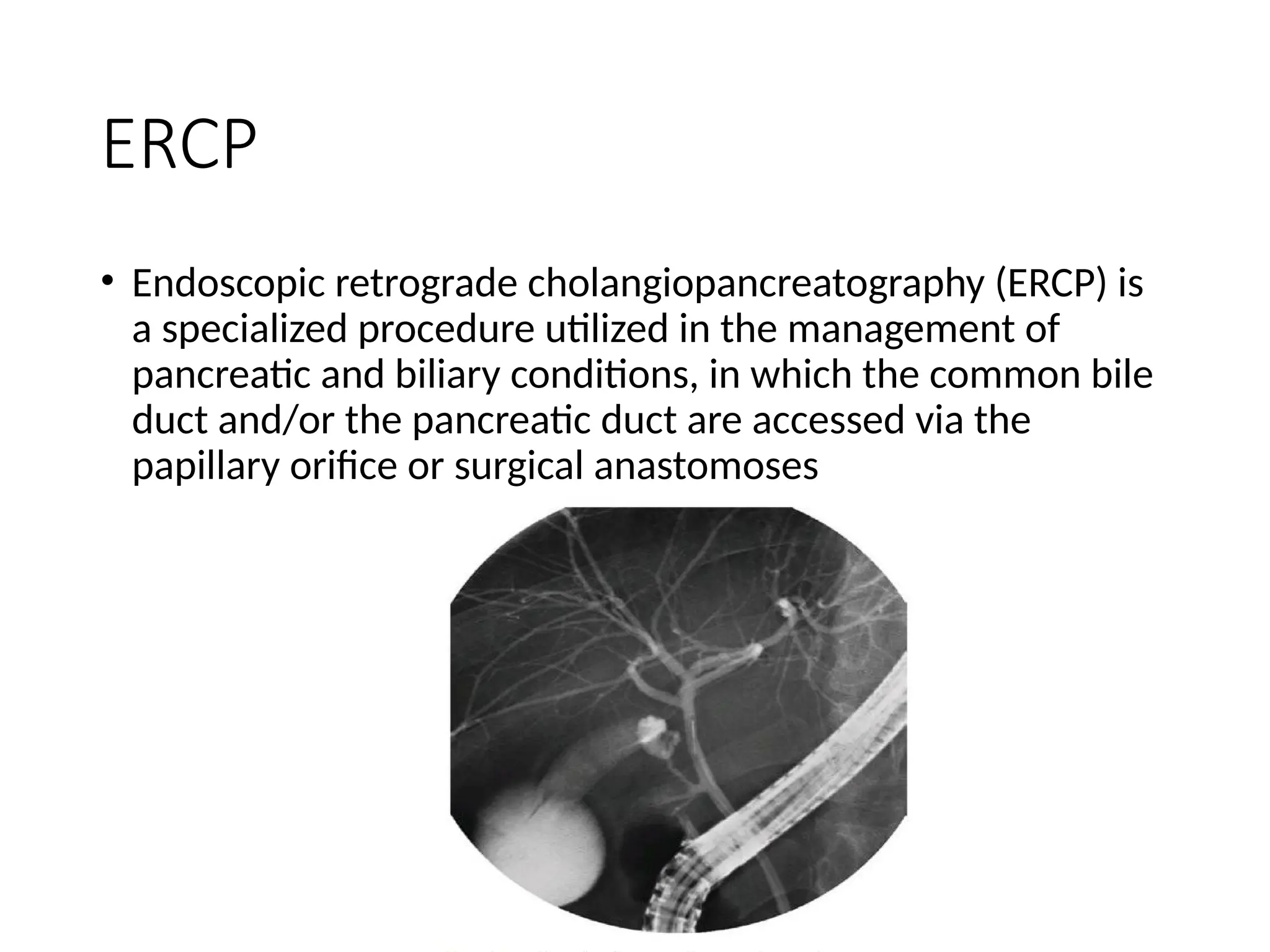 Parts of ercp, principles, indications .pptx