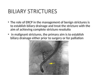 Parts of ercp, principles, indications .pptx
