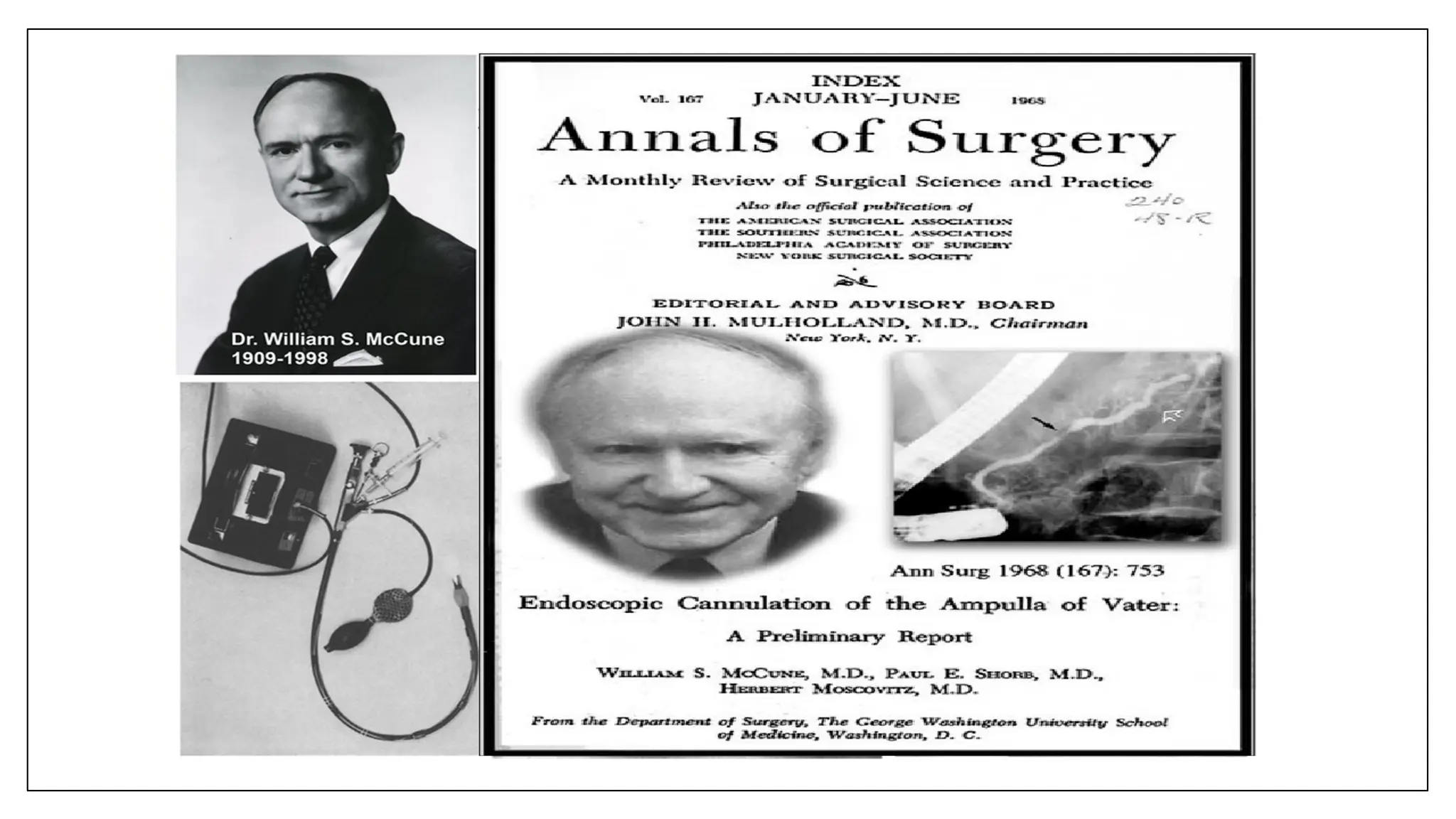 Endoscopic Retrograde Cholangiopancreatography (ERCP): overview and ...