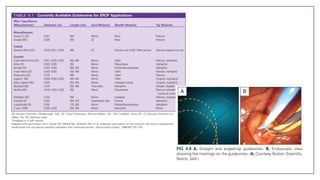 Endoscopic Retrograde Cholangiopancreatography (ERCP): overview and ...