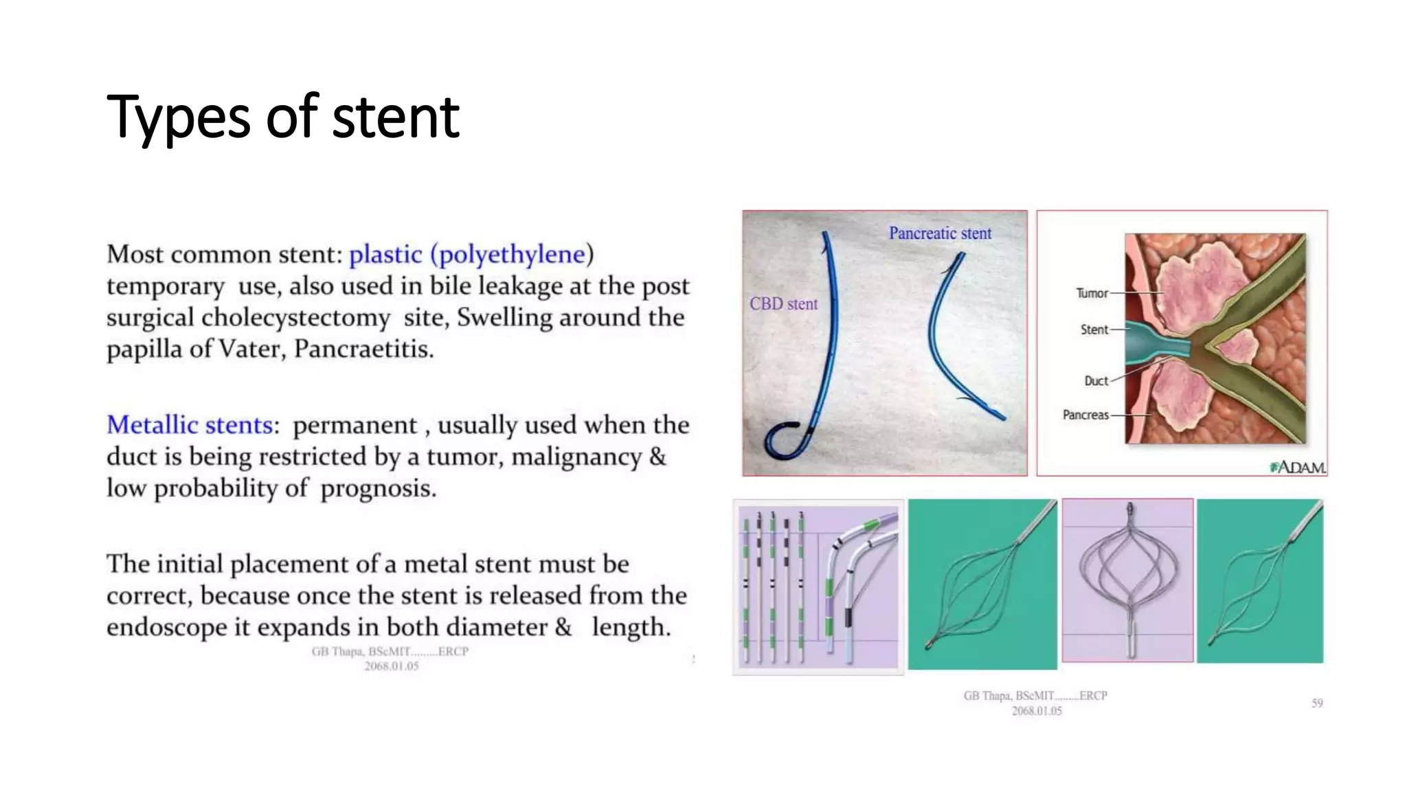 ERCP (1).pptx