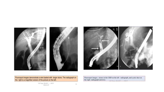 ERCP (1).pptx