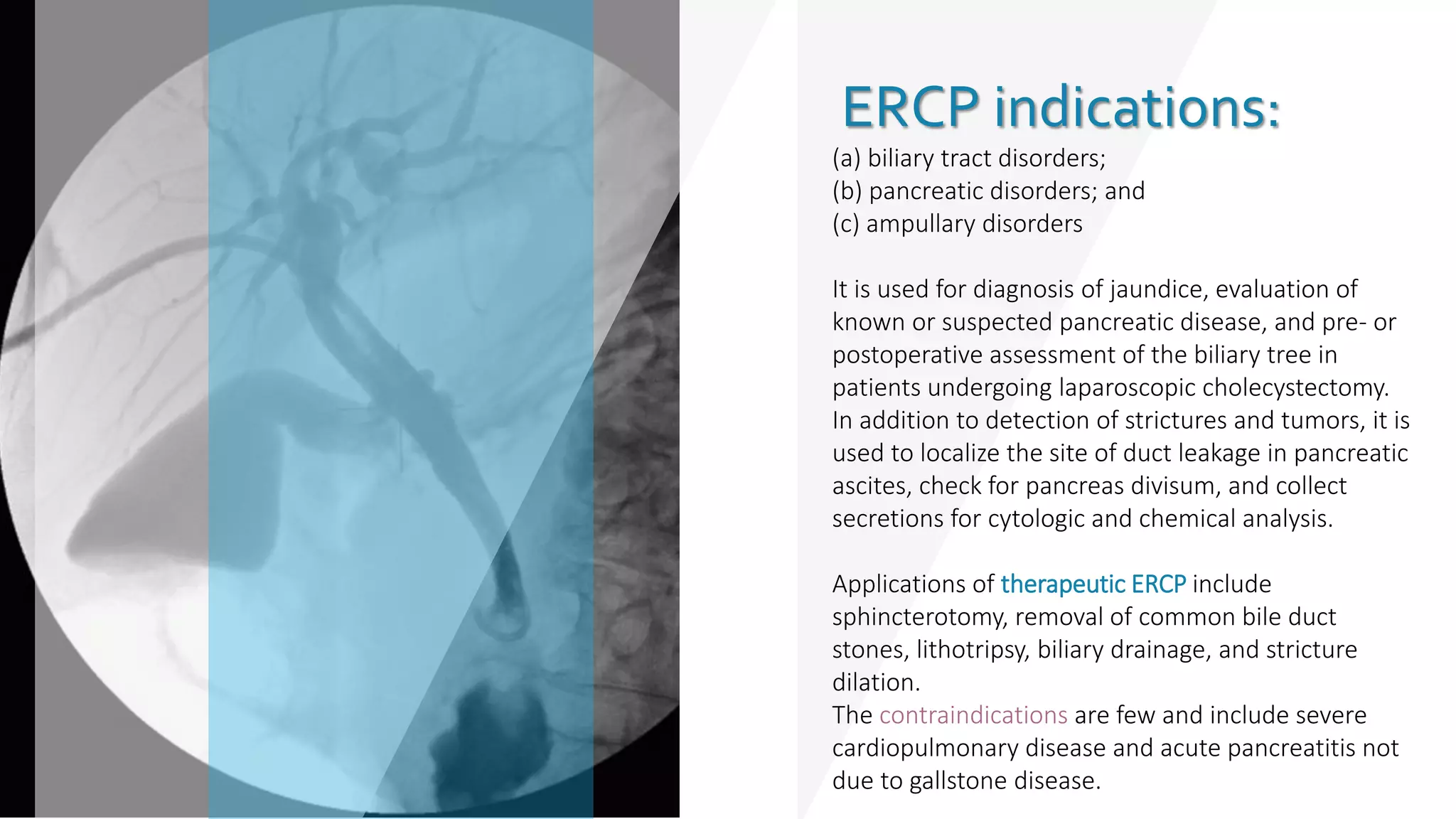 Ercp complications copy | PPTX