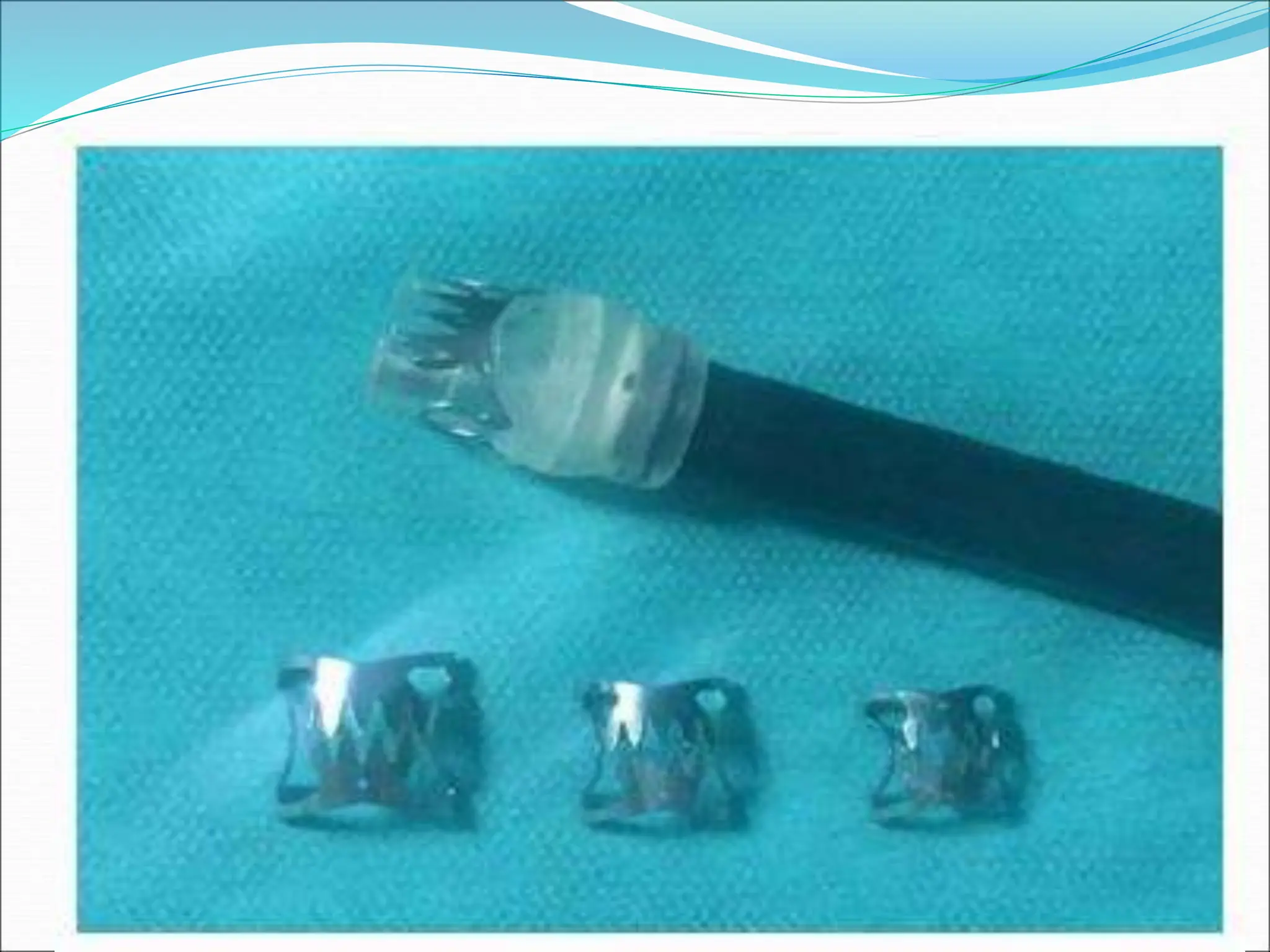 ERCP procedure/management and literature review | PPT