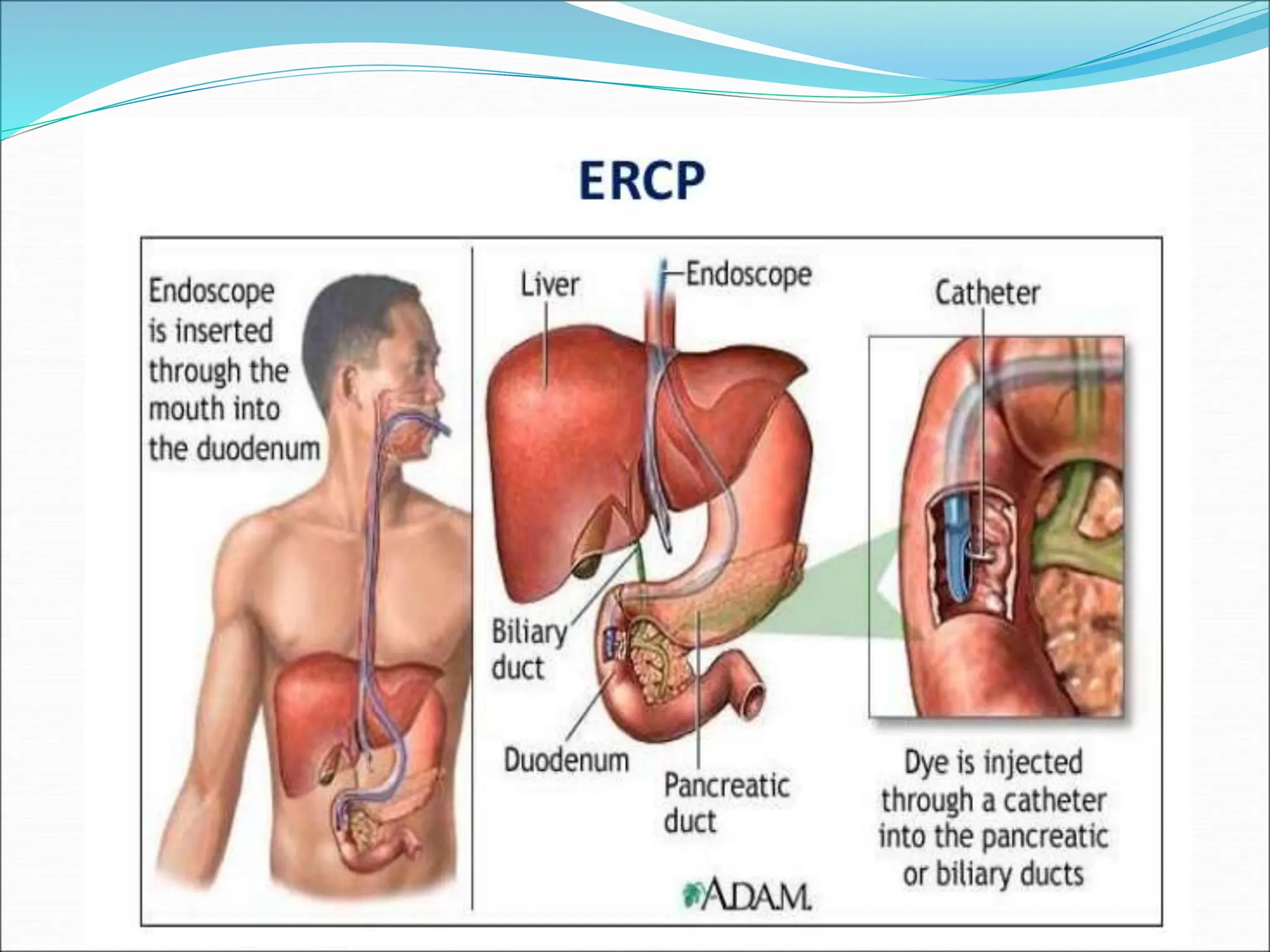 ERCP procedure/management and literature review | PPT