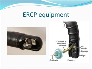 ERCP procedure/management and literature review | PPT