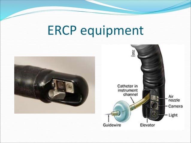 ERCP procedure/management and literature review | PPT | Digestive Disorders | Diseases and ...