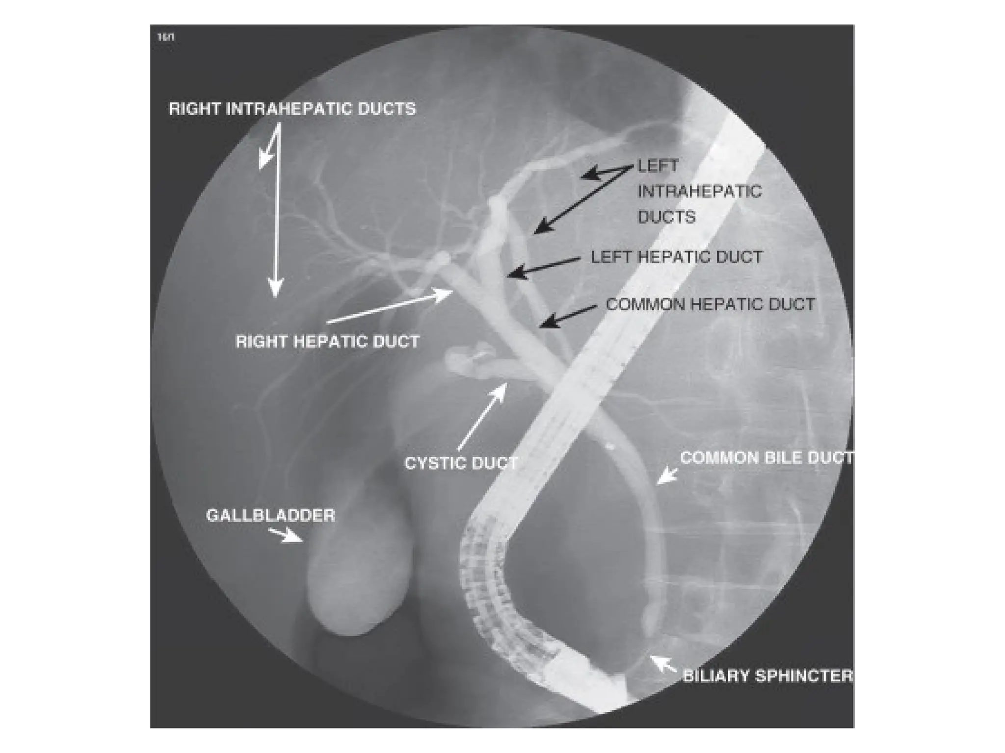 Endoscopic Retrograde Cholangiopancreatography .pptx