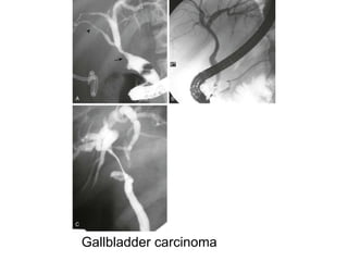 Endoscopic Retrograde Cholangiopancreatography .pptx