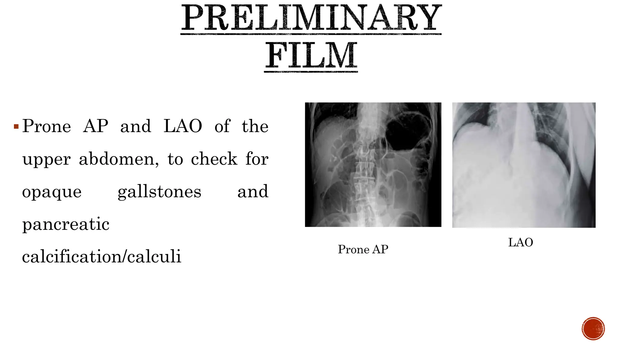 (ERCP) Cholangiopancreatography Bile ducts procedure | PPTX